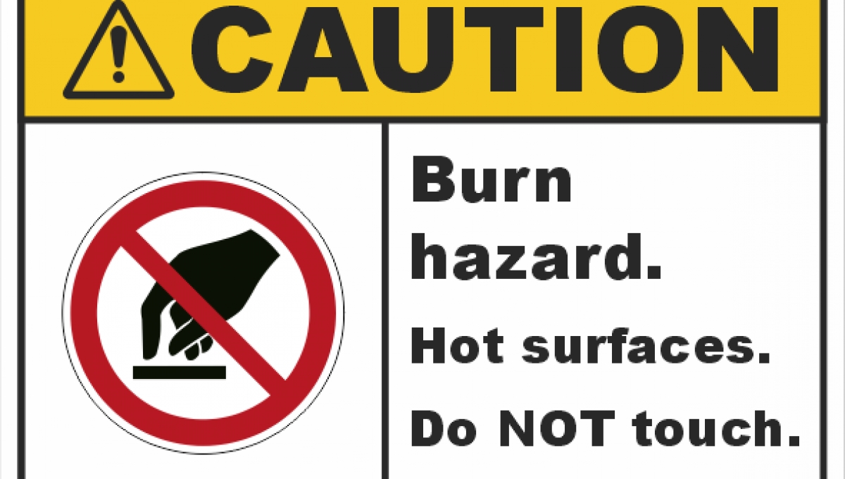 Burn hazard. Hot surfaces. Do NOT touch sign | Burn hazard | Burn ...
